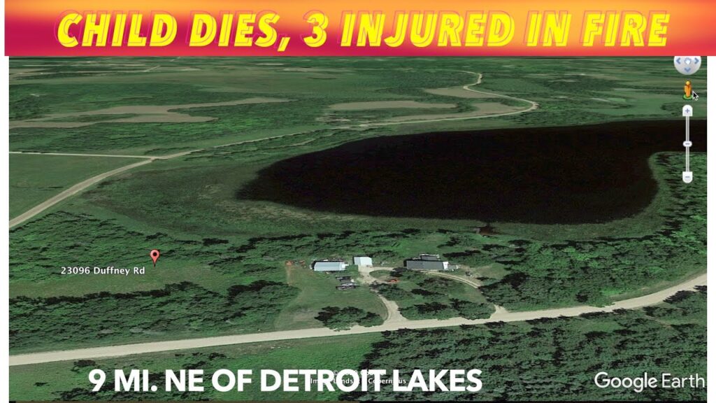 3 Family Members Injured In Fire By Detroit Lakes Archives - iNewZ