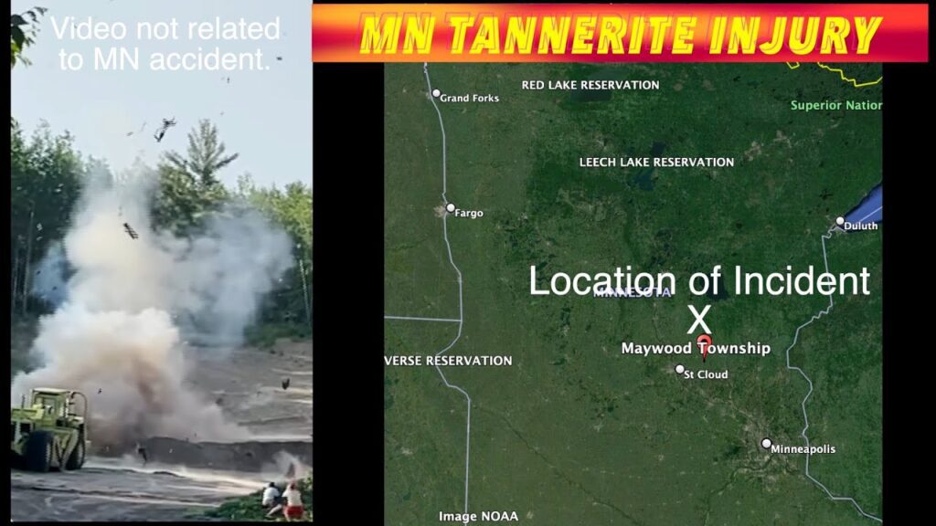 Minnesota Tannerite Injury - iNewZ