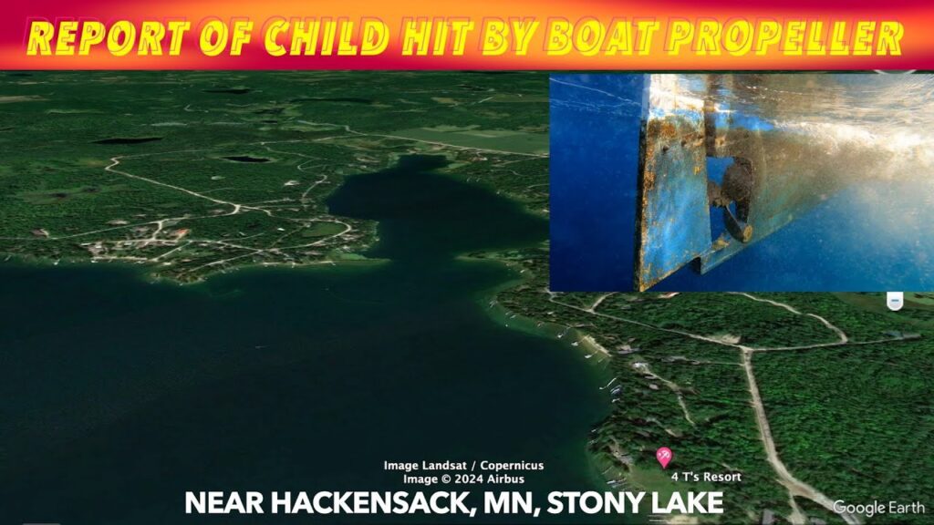 BREAKING NEWS: Report Of Child Hit By Boat Propeller In Minnesota, Life ...