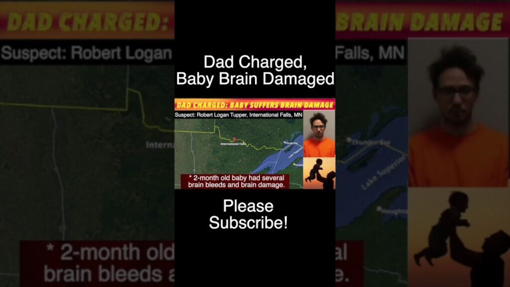 DAD CHARGED: 2-Month Old Baby Suffers Brain Damage - iNewZ
